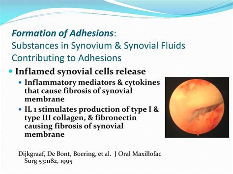Ppt Importance Of Mobilization Of The Tmj Orthopedic Literature