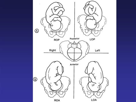 Fetal Head Maternal Pelvis Pelvimetry