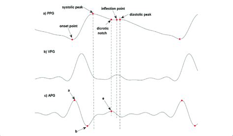 Typical Ppg Signal A Its First Derivative Vpg B And Second