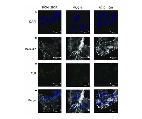 Pgr Expression In Nci H295r Muc 1 Cell Lines And Acc115m Primary