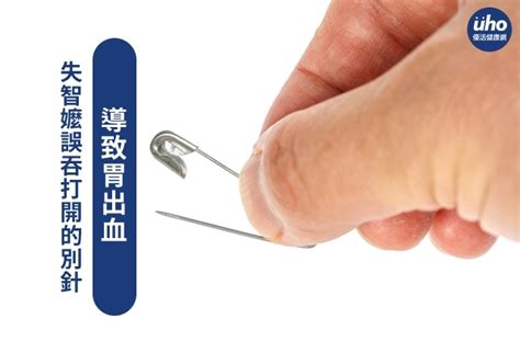失智嬤誤吞打開的別針 導致胃出血uho優活健康網