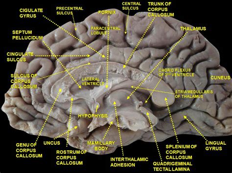 Entorhinal Cortex Entorhinal Area