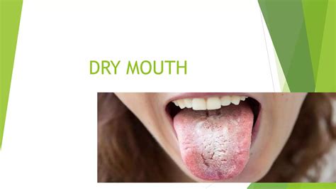 Common Oral Disease And Condition Ppt