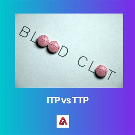 Itp Vs Ttp Difference And Comparison