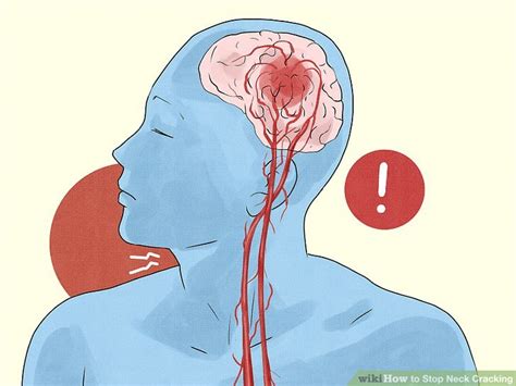 Ways To Stop Neck Cracking WikiHow