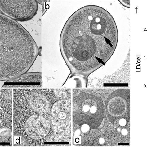 Electron Microscopy Of Wild Type Cells And Lipid Droplet Formation