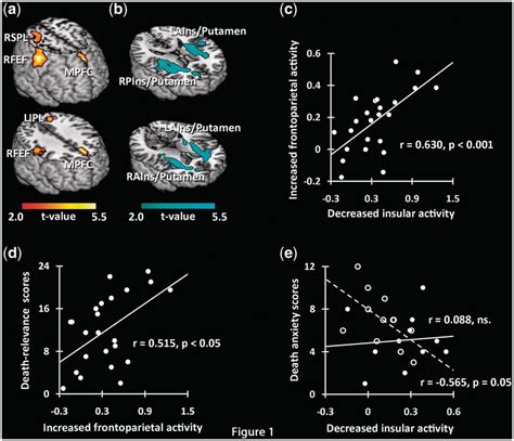Brain Imaging Results A Transient Increased Frontoparietal Activity