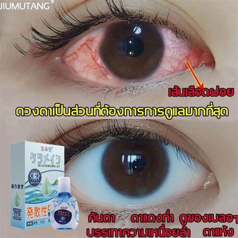 ของแท้ พร้อมจัดส่งjiumutang น้ำยาล้างตา 10ml สูตรเมล็ดขี้เหล็กสมุนไพร