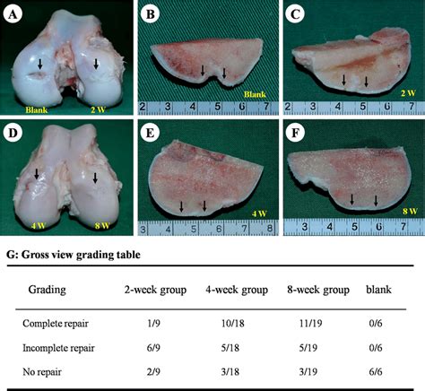 Gross View And Grading Of Repaired Regions Most Osteochondral Defects