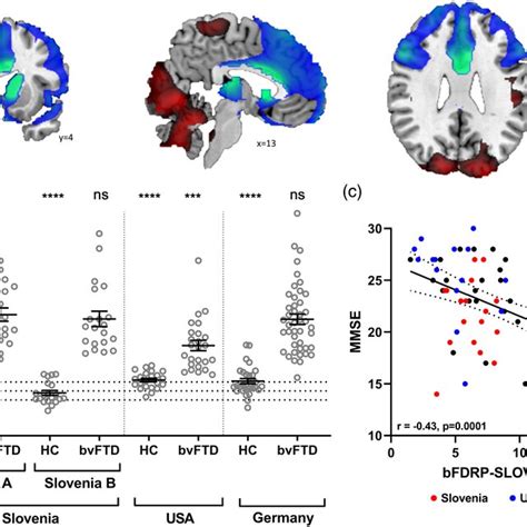 A Topography Of Behavioral Variant Frontotemporal Dementia Bvftd Download Scientific