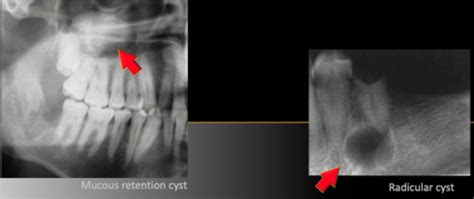 Intro And Developmental Dental Abnormalities Flashcards Quizlet
