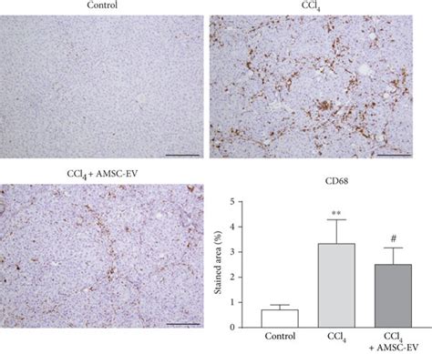 Effect Of Amsc Evs In Rats With Ccl4 Induced Liver Fibrosis A