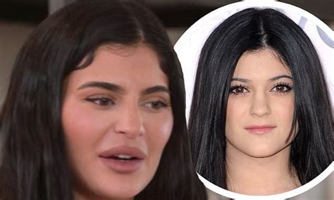 Kylie Jenner Plastic Surgery Kylie Jenner Regrets Plastic Surgery