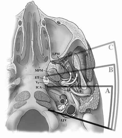 Infratemporal Fossa
