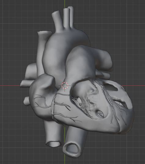 Stl File 3d Model Of Ventricular Septal Defect 💜・3d Print Model To Download・cults