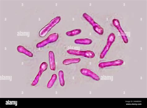Clostridium Botulinum Bacteria Clostridium Botulinum Black And White