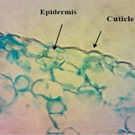 Cross Section Of Stem A Parenchyma Cells Of Stem Cultured In Control