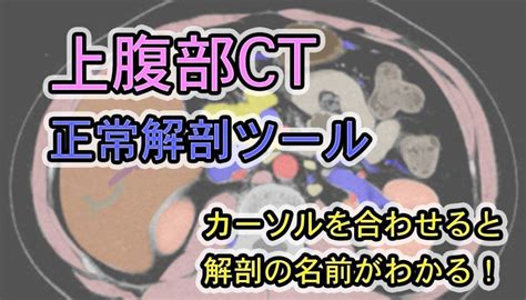 Ct