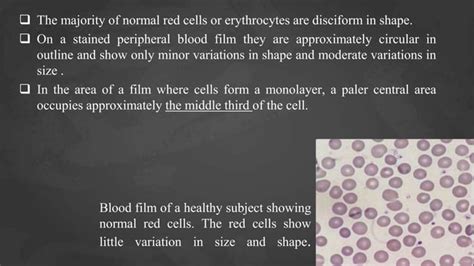 Morphology Of Erythrocytes PPTX Blood Disorders Diseases And Conditions