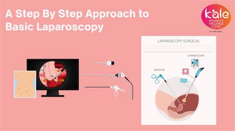 A Step By Step Approach To Basic Laparoscopy Youtube