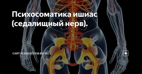 Психосоматика ишиас седалищный нерв Сайт психологов Дзен