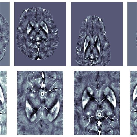 Sample Outputs Of The Data Augmentation Pipeline To Create New Images