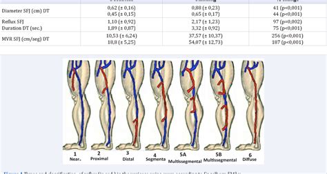 Figure 1 From Vascular Ultrasound Exam For Varicose Veins Importance