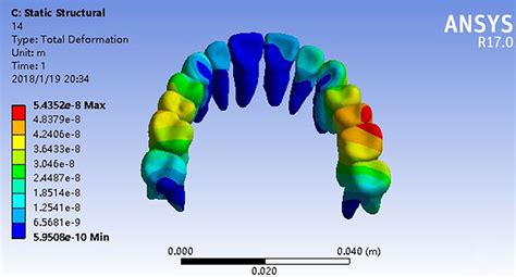 A 3 Dimensional Finite Element Analysis Ijgm