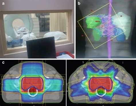 Radiation Therapy Simulation All About Radiation