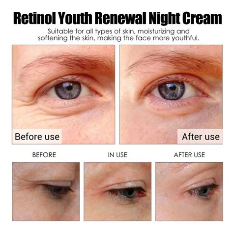 Hoygi Retinol Face Cream Firming Lifting Facial Skin Fade Fine Lines