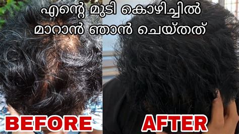 മുടി കൊഴിച്ചിൽ ഇനി ഉണ്ടാവില്ല എൻ്റെ അനുഭവത്തിൽ നിന്നും Youtube