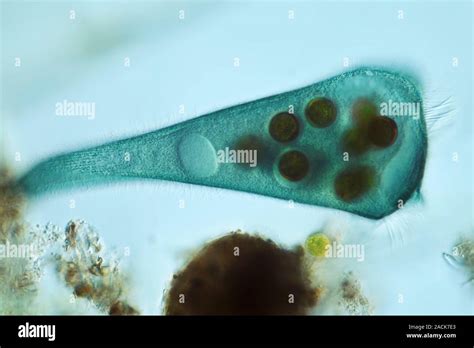 Stentor Coeruleus Protozoan Light Micrograph Of Stentor Coeruleus