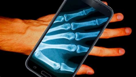 X Ray App On Your Cell Phone Free And Easy To Use App
