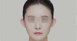 精致脸型雕塑 无锡尚美整形美容医院