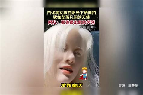白化病女孩在阳光下自信自拍，犹如坠落凡间的天使！