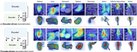 [논문 리뷰] Hi End Mae Hierarchical Encoder Driven Masked Autoencoders Are Stronger Vision Learners