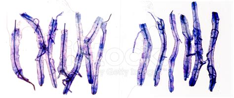 Science Glass Microscope Slide With Fungus Inside Plant Tissue S Stock
