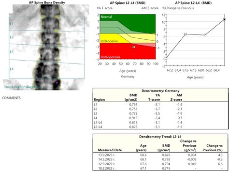 Osteodensitometry Excelsior