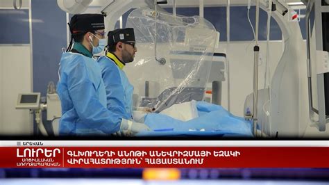 Գլխուղեղի անոթի անևրիզմայի եզակի վիրահատություն՝ Հայաստանում Youtube