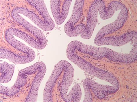 Transitional Epithelium Slide Labeled