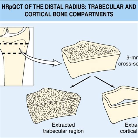 7 Illustration Of High Resolution Peripheral Quantitative Computed