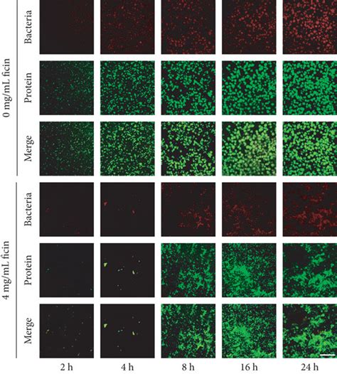 A Protein And Bacterial Staining Of S Mutans Biofilm Bacteria Was