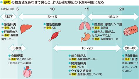 Ld（乳酸脱水素酵素）の読み方｜「細胞傷害」を読む検査 看護roo [カンゴルー]