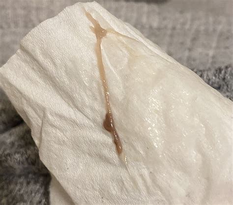 Implantation Bleeding Mumsnet
