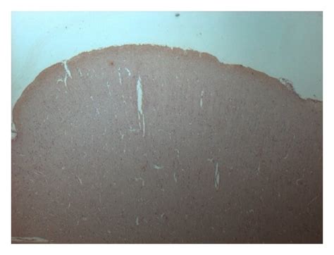 A The Control Group Showed Severe Cortex Injury And Brain Tissue Download Scientific Diagram