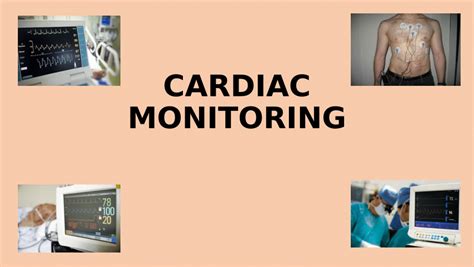 Pdf Cardiac Monitoring