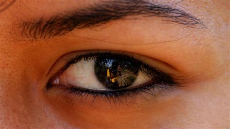 Genetic Mutation In Human Eyes