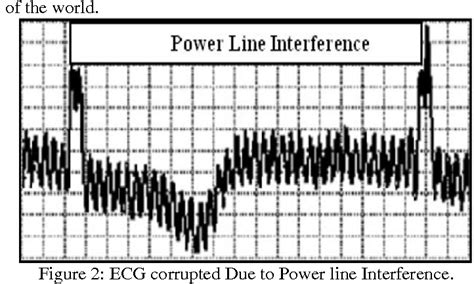 Figure 3 From Reduction Of Power Line Interference In Ecg Signal Using