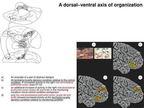 Ppt Lateral Prefrontal Cortex Architectonic And Functional