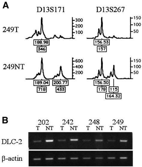 Loh And Rt Pcr Results A A Representative Case Showing Loh With Both